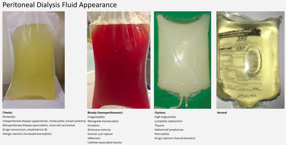 What is this. We think urine : r/Whatisthis