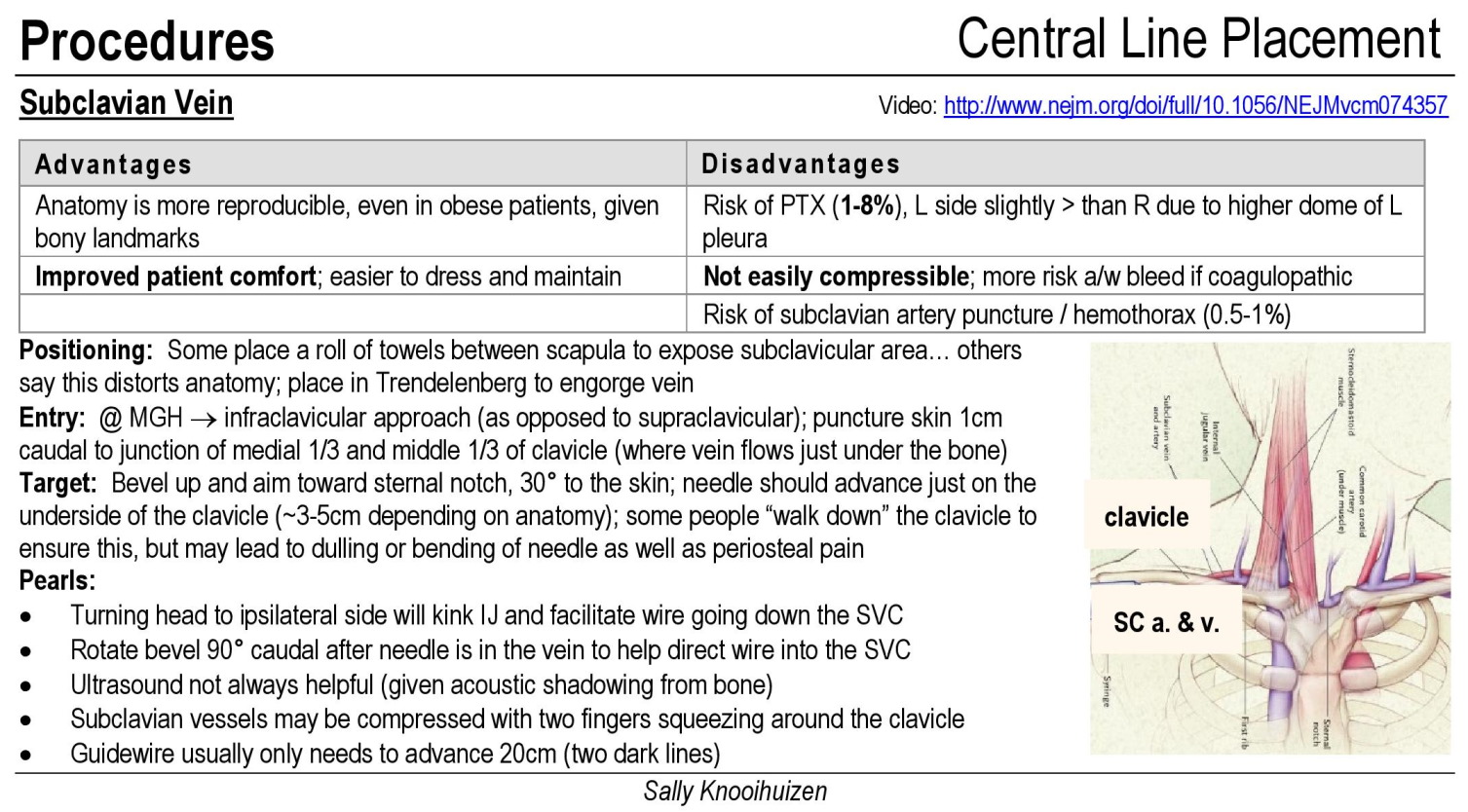 Subclavian Vein Central Line Landmarks