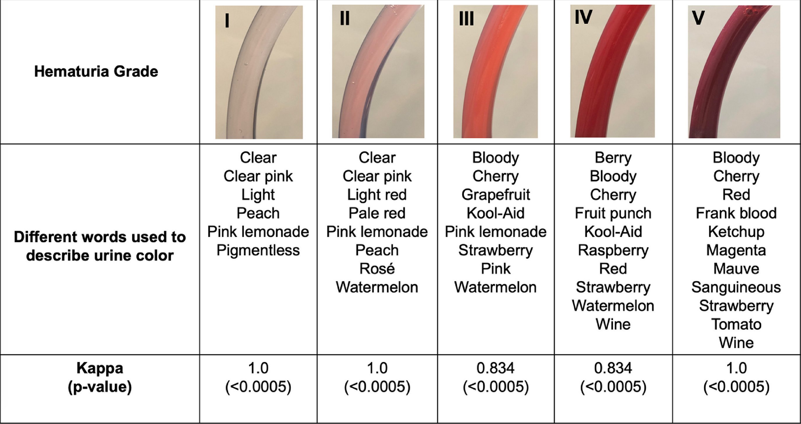 Hematuria Grading Scale And Descriptors Grade I Clear GrepMed