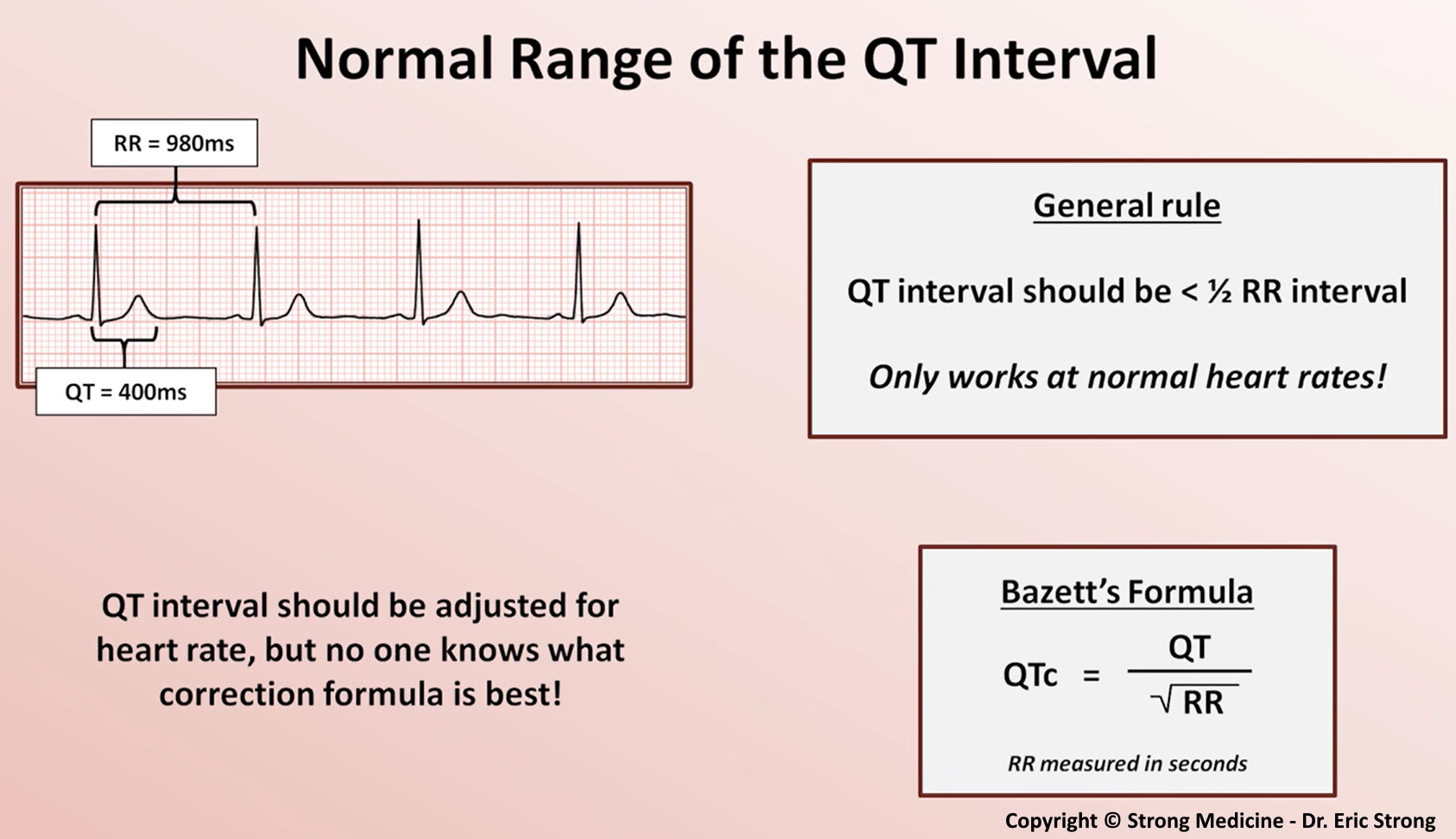Purta Propor ional Marxist Qt Interval Calculation C tiga Punte apte 