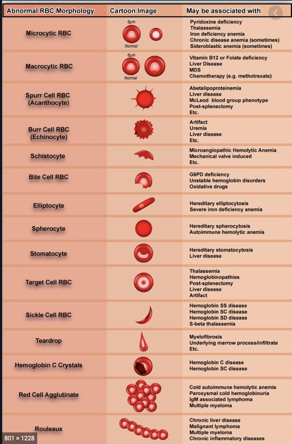 Red Blood Cell RBC Morphology Microcytic RBC Pyridoxine GrepMed Red Blood Cell RBC Morphology Microcytic RBC Pyridoxine GrepMed