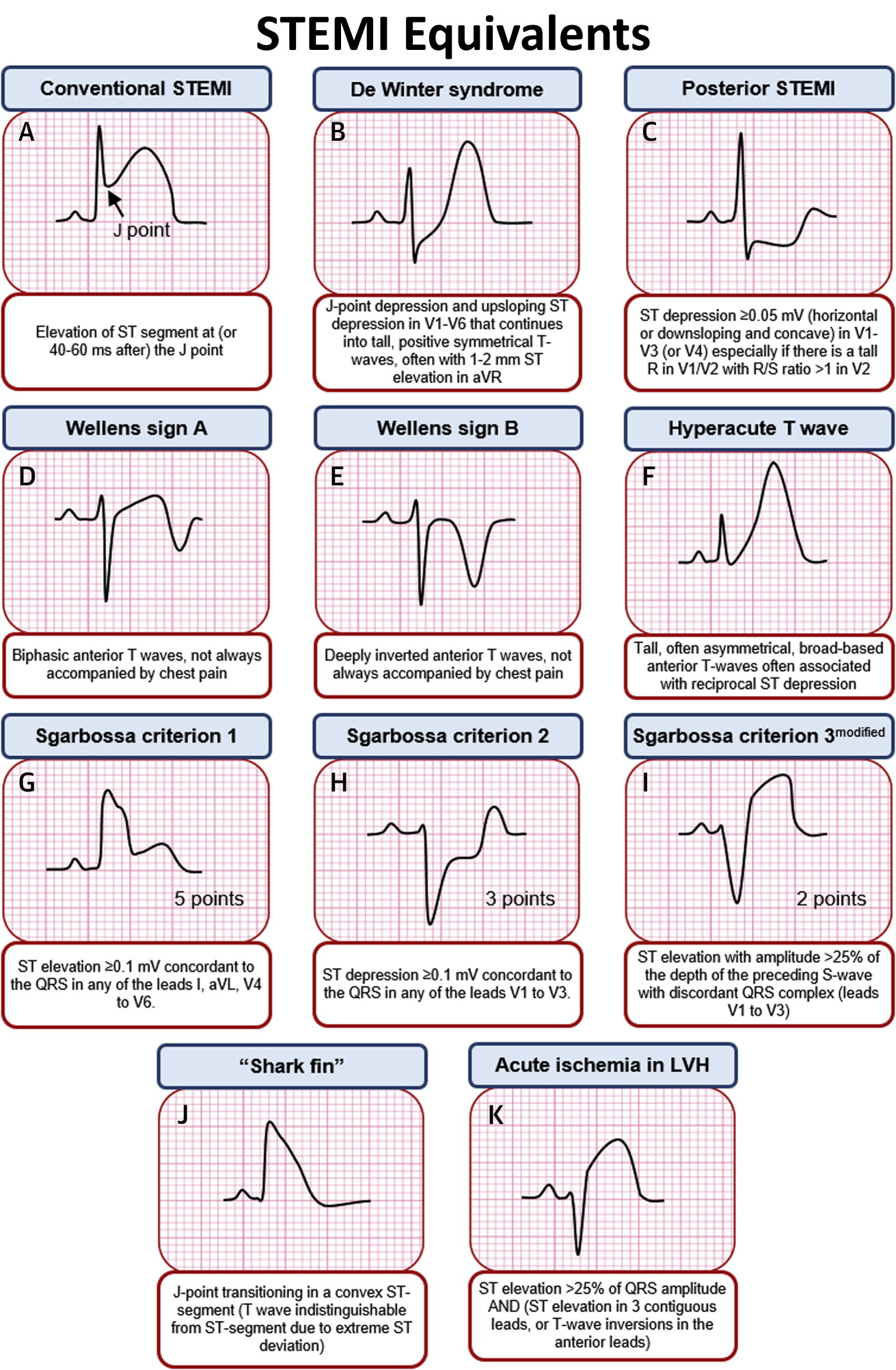 ECG ProductiveMedic
