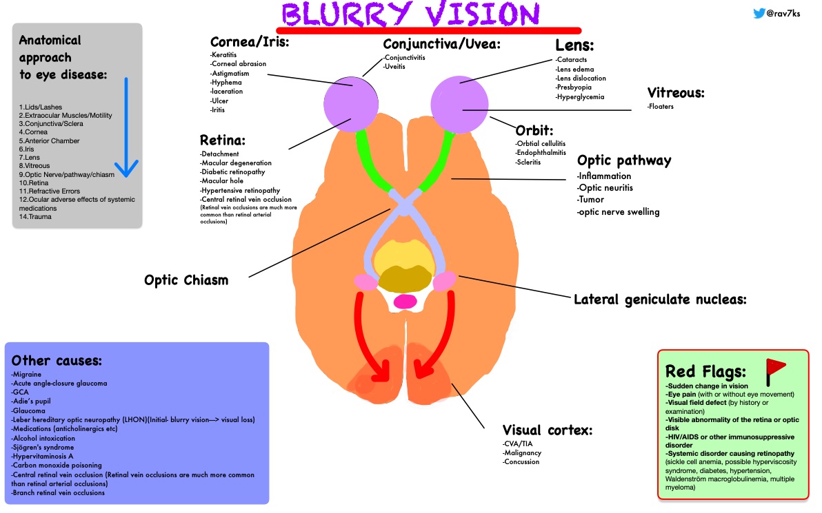 Blurry Vision Differential Diagnosis Framework GrepMed Blurry Vision Differential Diagnosis Framework GrepMed