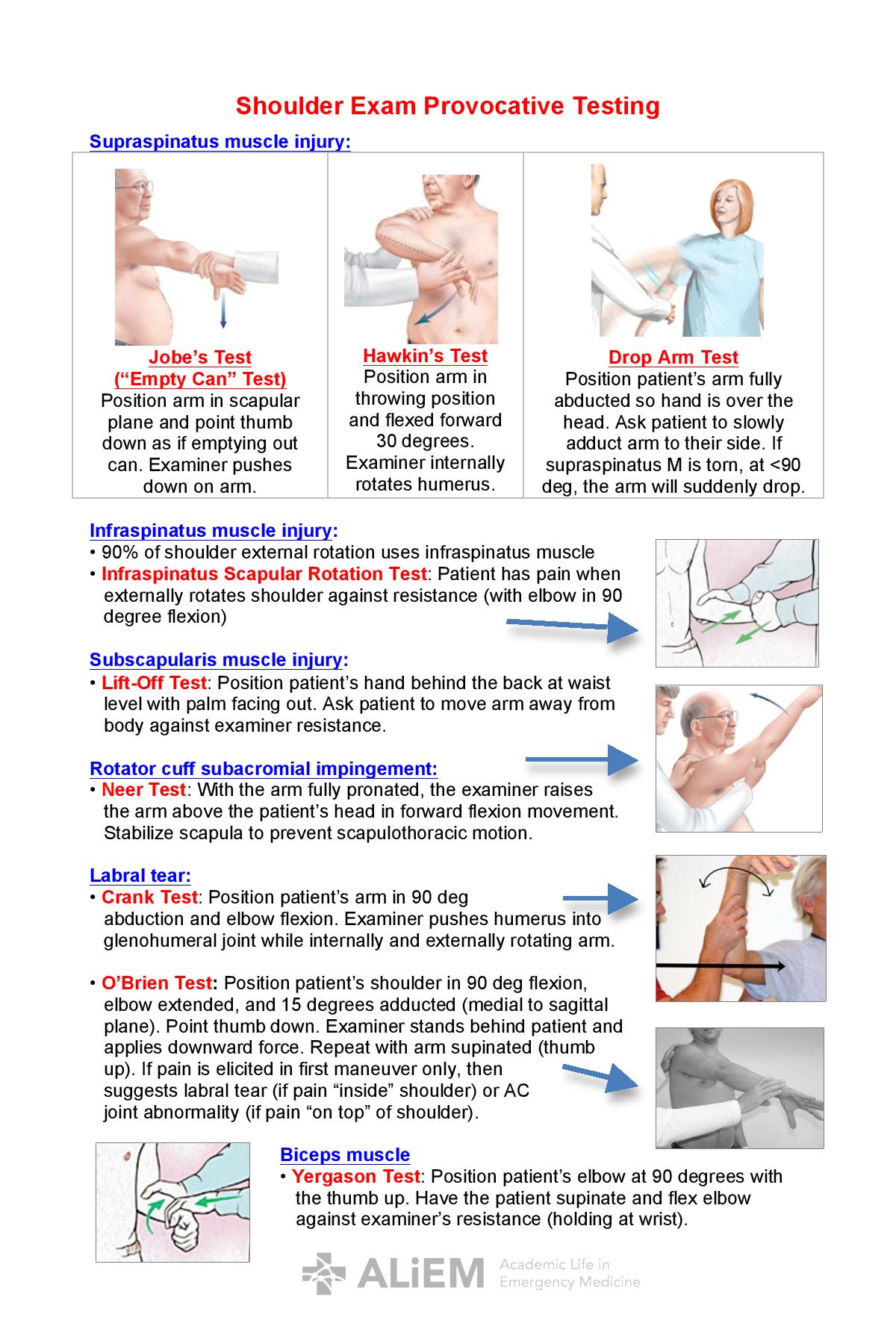 Shoulder Exam Provocative Testing Supraspinatus GrepMed