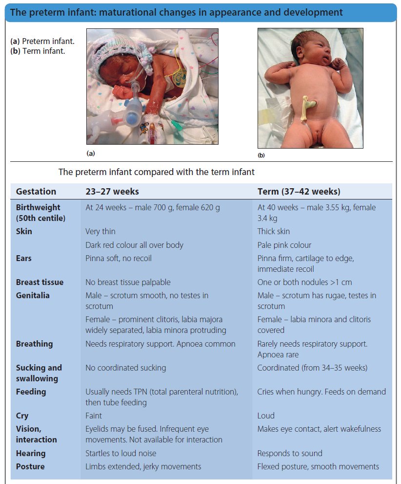 The Preterm Infant Compared With The Term Infant Preterm GrepMed