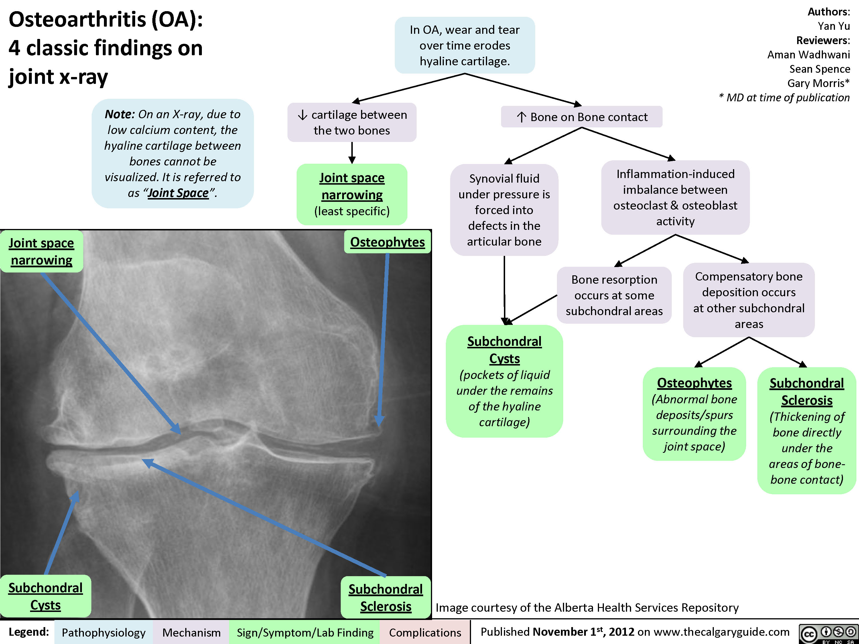 Osteoarthritis OA X ray Features Joint Space GrepMed